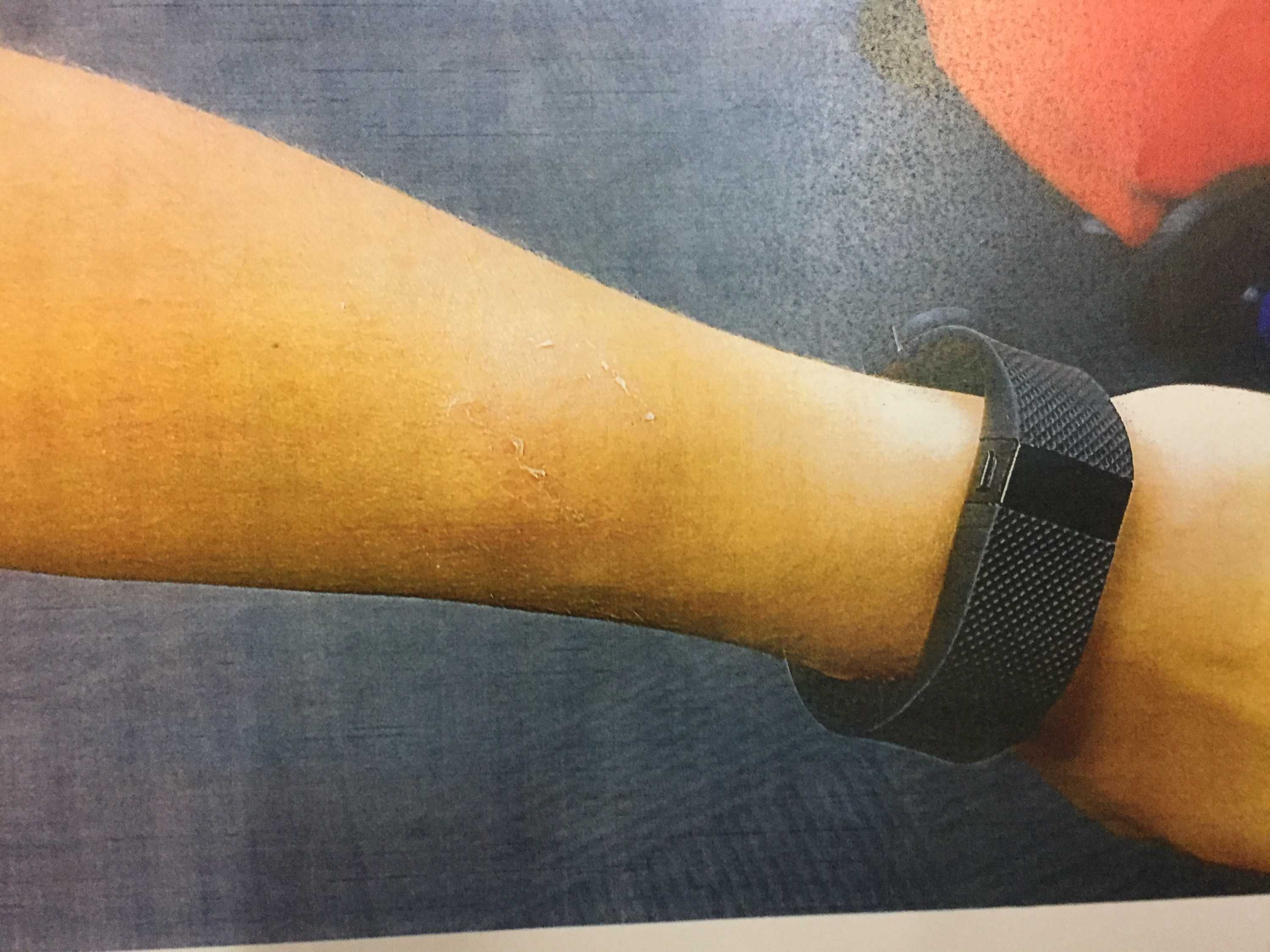 Woman avoids jail for biting policewoman, days after promised crackdown ...