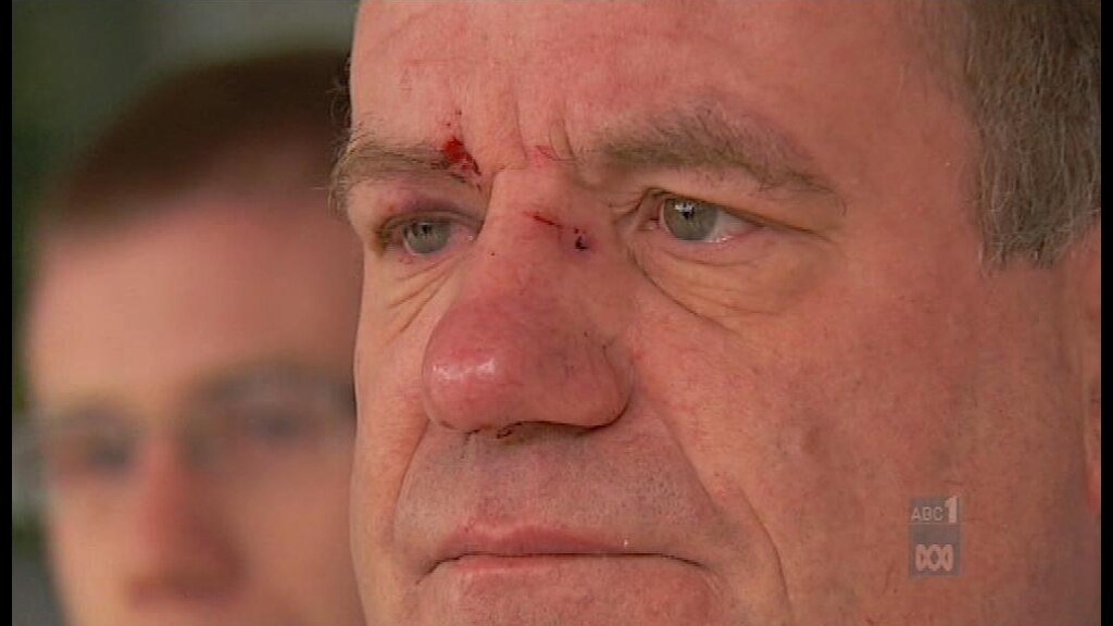 Foley's accused attacker faces court - ABC News
