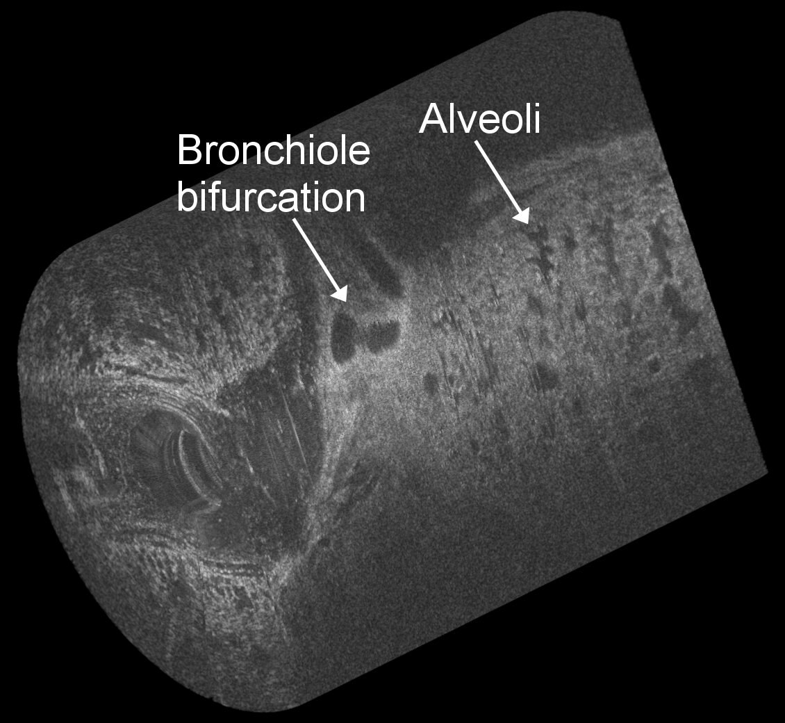 Scientists develop needle microscope to pinpoint cancer cells often ...