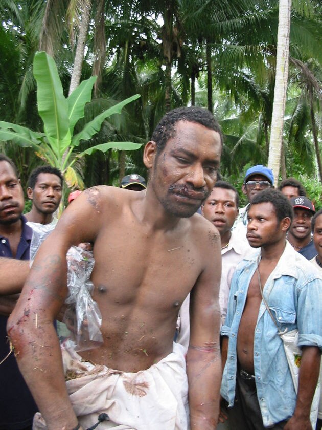Angry PNG villagers kill 'Black Jesus' cult leader - ABC News