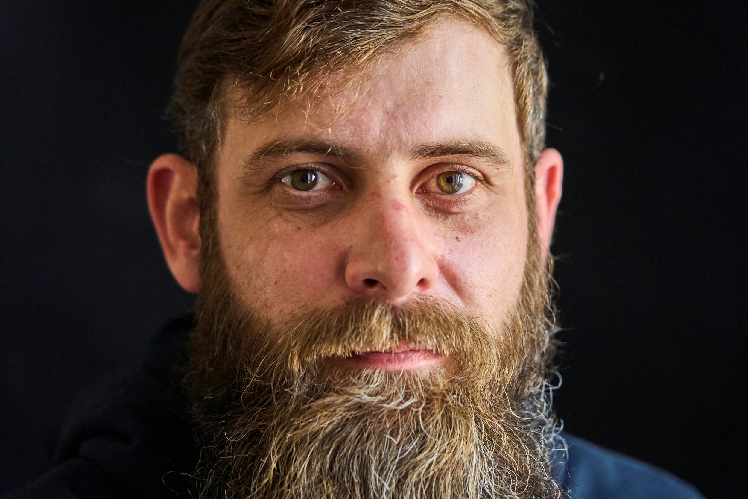 Electric shock survivor Bradley Richardson warns farmers to pay ...