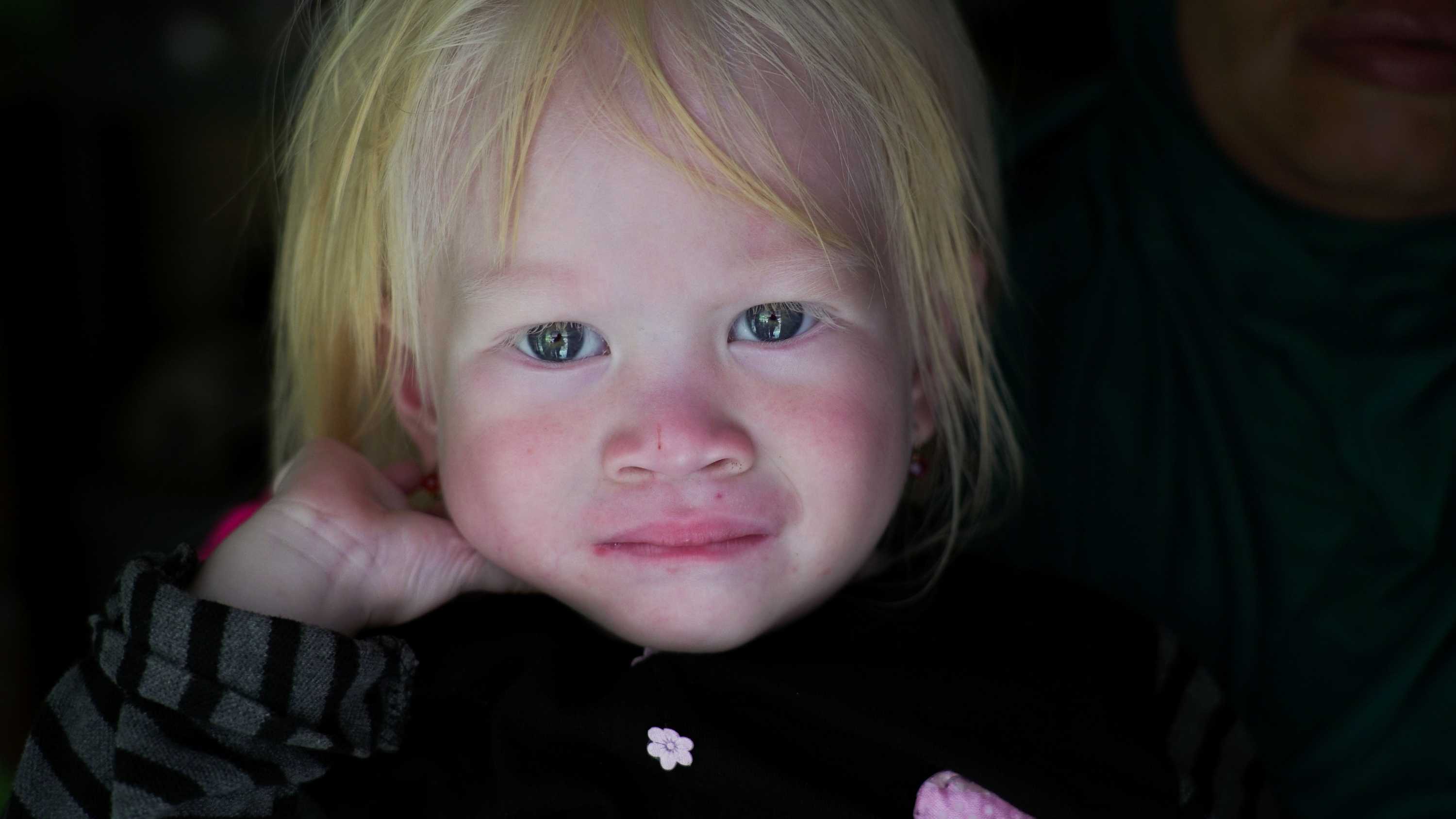 'It's hard being white': Indonesia's albino village - ABC News