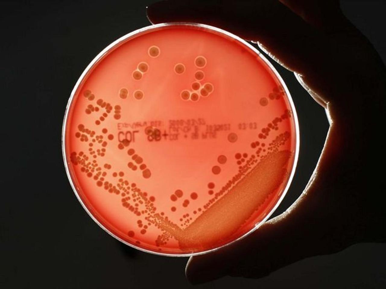 Rise of the Superbugs - ABC News