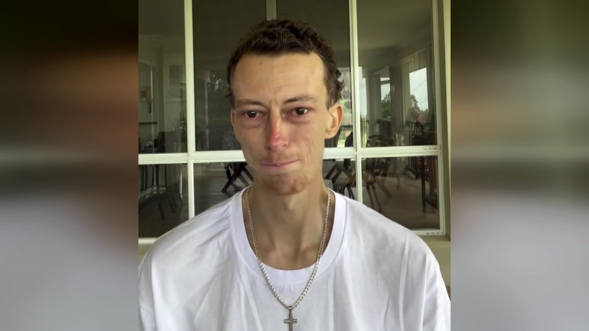 Brett Mckay shared his battle against testicular cancer on Instagram ...