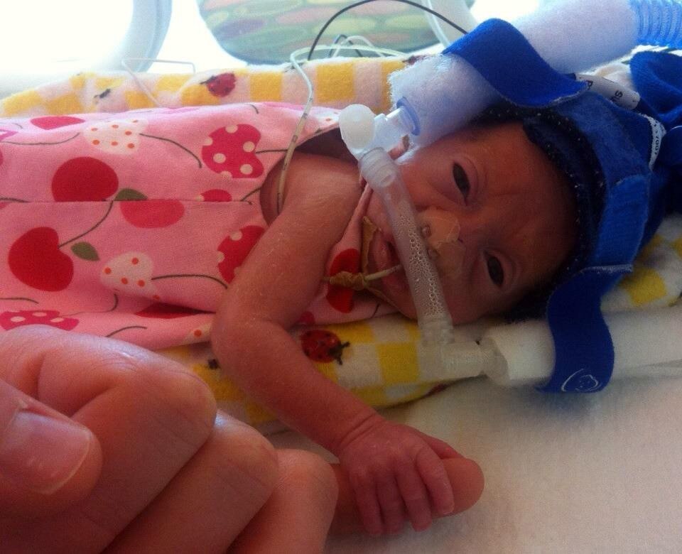 Birth PTSD: Mothers speak out about long-term trauma - ABC News