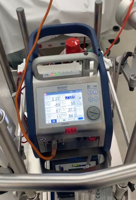 Ventilators are well-known, but there's another machine that might save ...