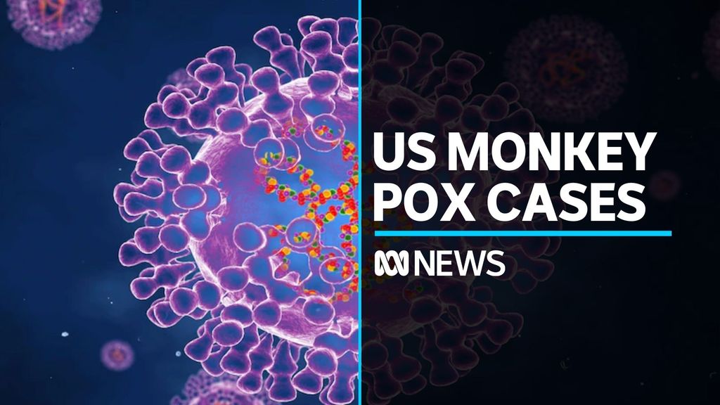 US rushing to secure monkey pox vaccines as cases spread - ABC News