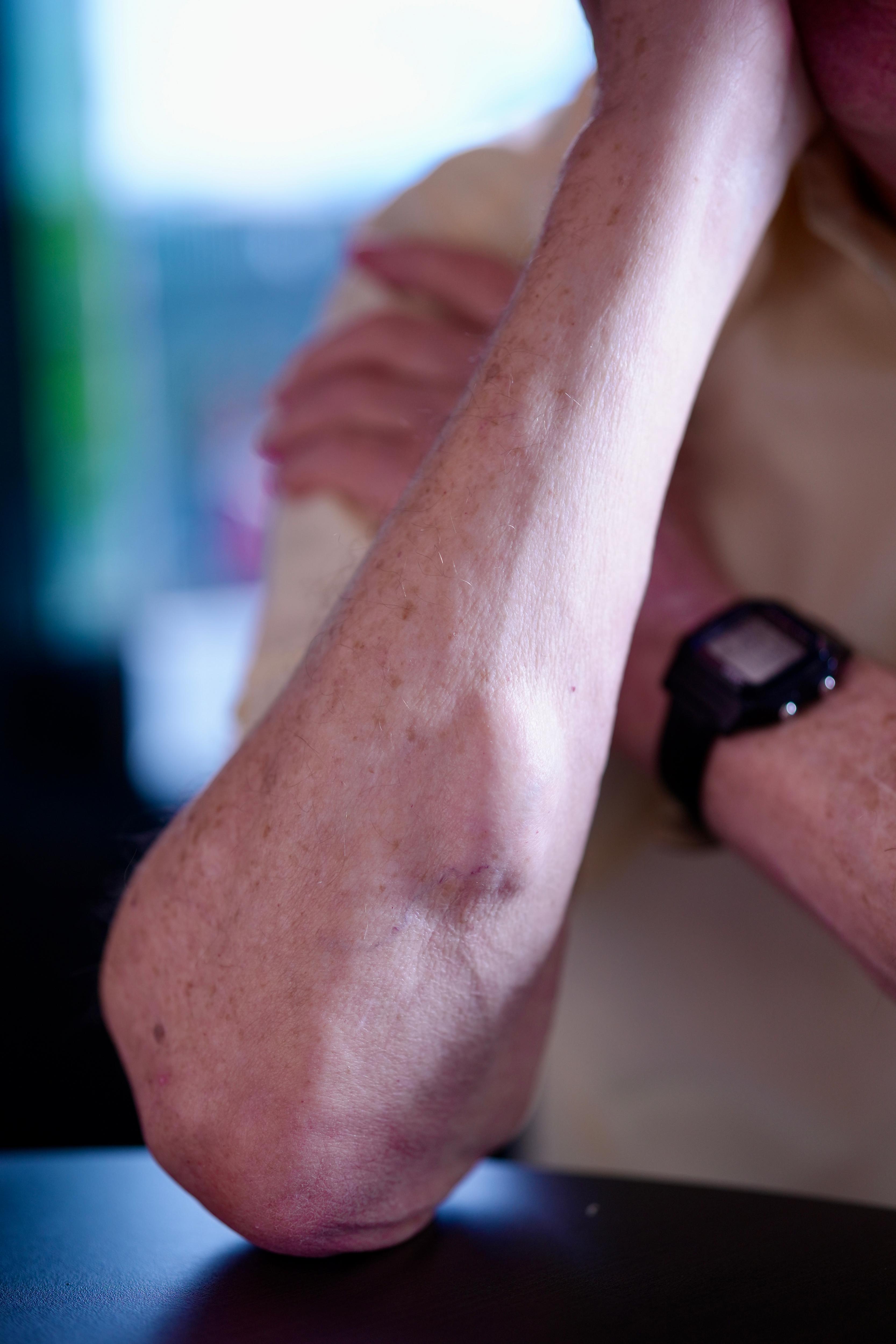 As Victoria's surgery waitlist grows, so do concerns over a 'hidden ...