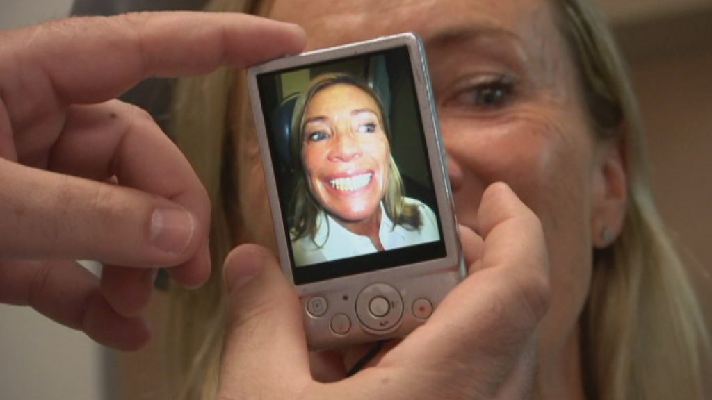 Susie Robinson gets a 3D printed jaw implant - ABC News