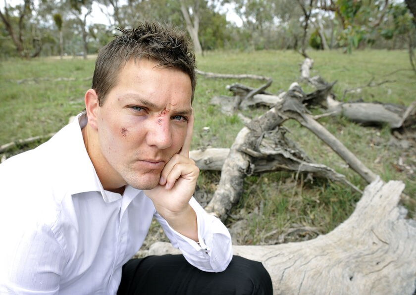 Kangaroo knocks runner unconscious - ABC News