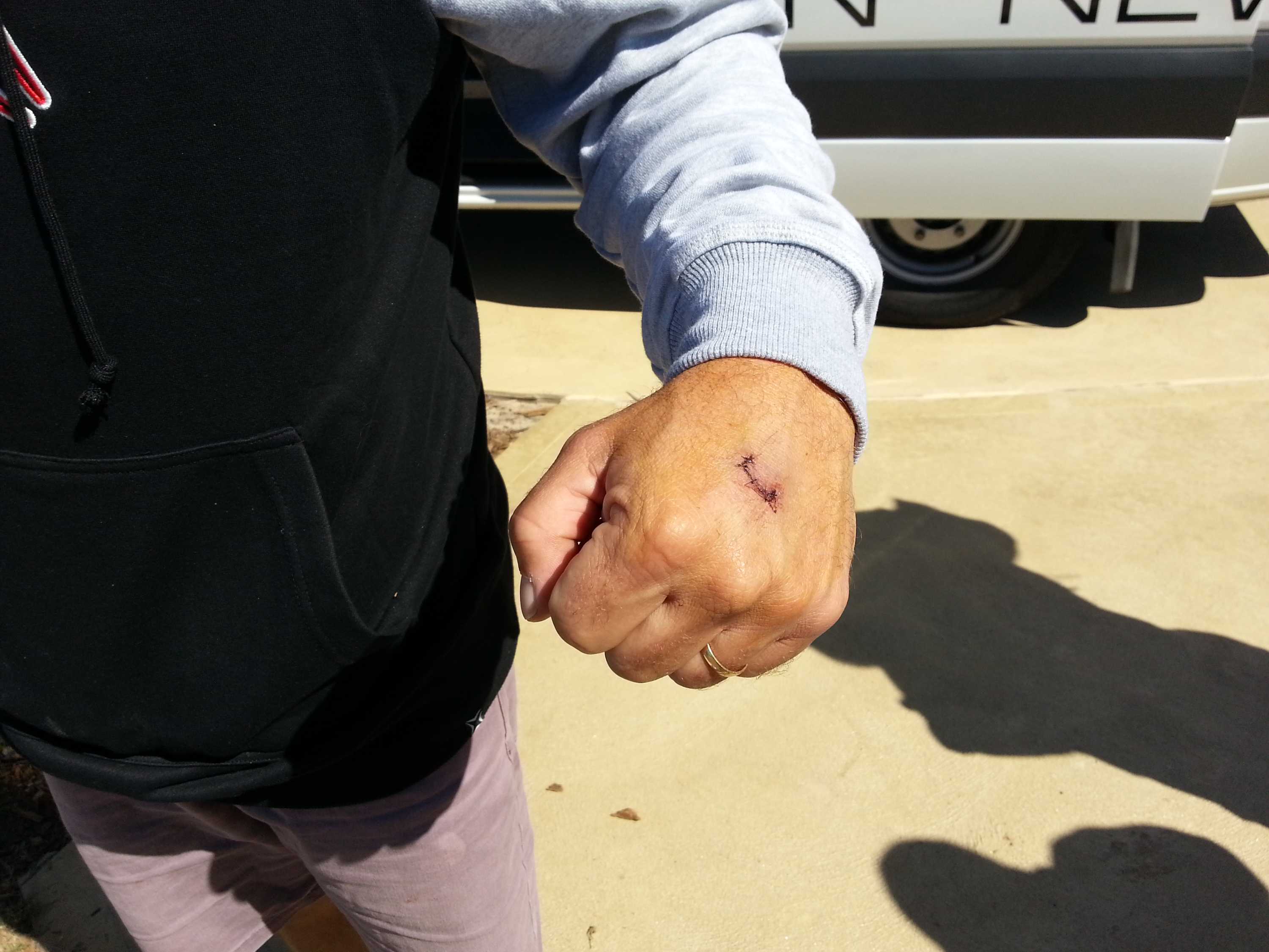 Shark attack: NSW surfer bitten at North Shelly Beach says it could ...