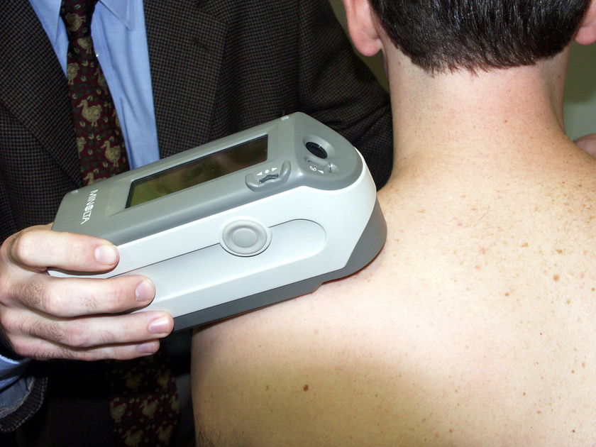 Australian success for new melanoma drug - ABC News