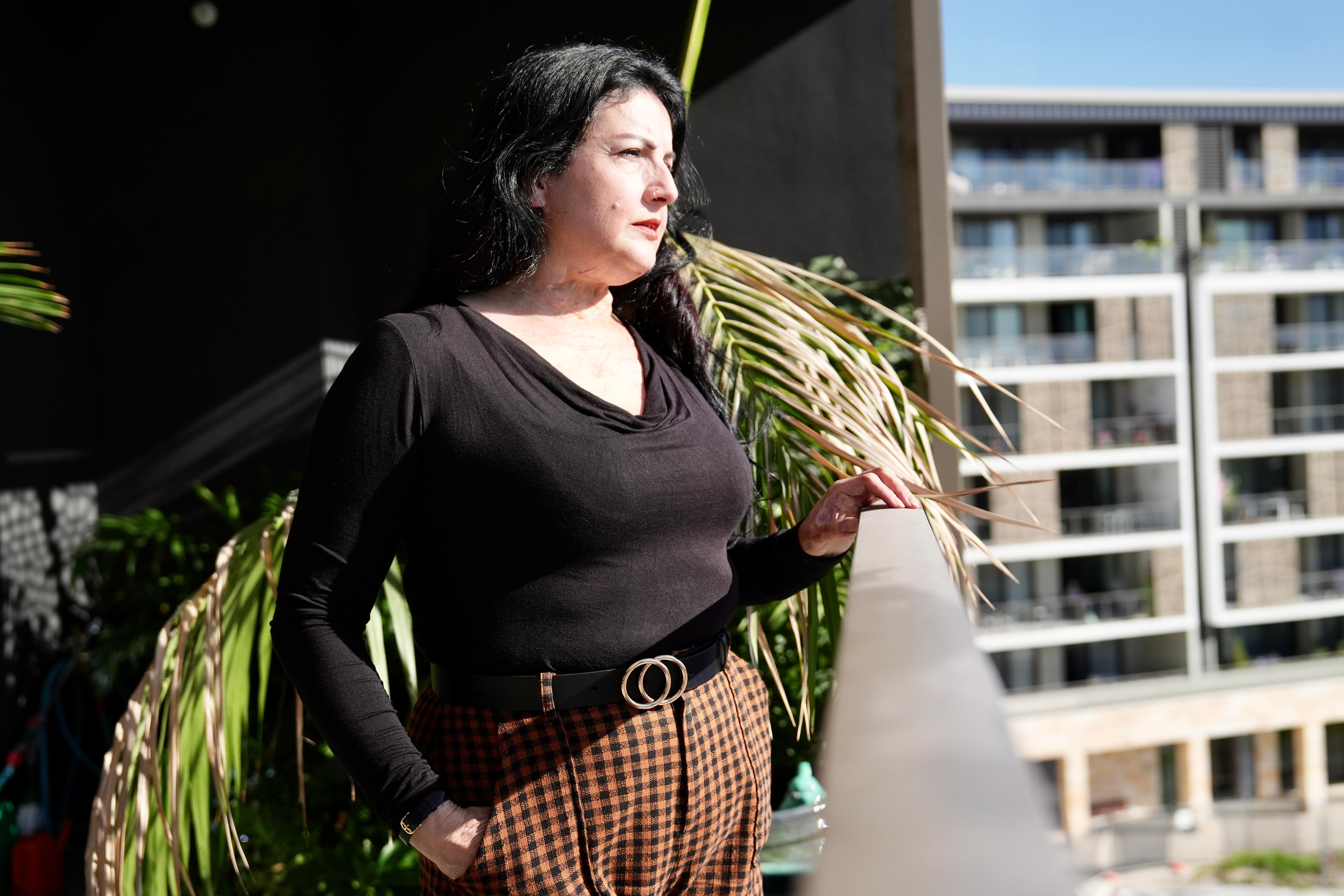 Reports of domestic violence burn injury cases likely 'tip of the ...