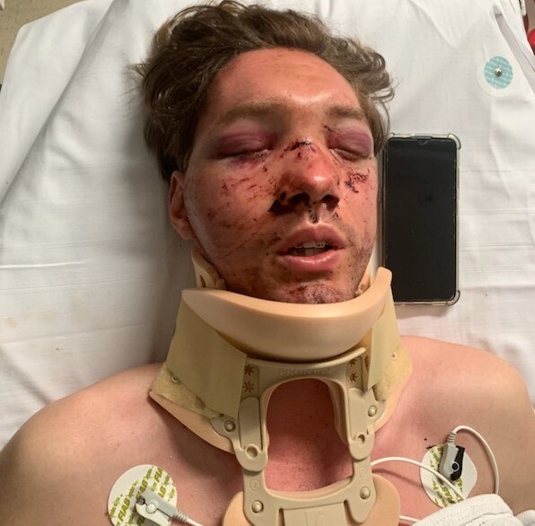 Adelaide pilot breaks face in crash landing and saves passenger - ABC ...