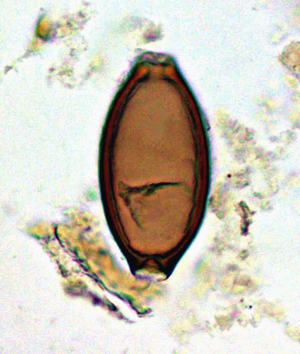 The place of ancient parasites in human disease and health - ABC Radio ...