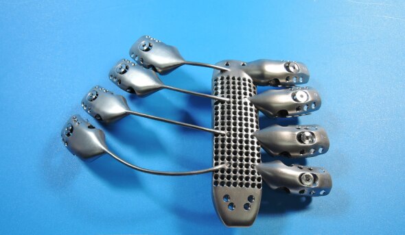 World-first operation implants 3D-printed titanium ribcage and sternum ...