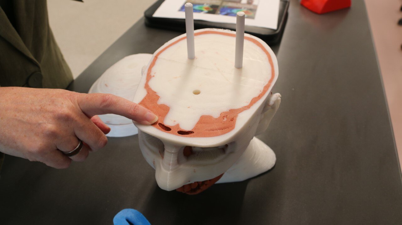 Brisbane bio-tech lab creates ‘revolutionary’ 3D-printed body parts to ...