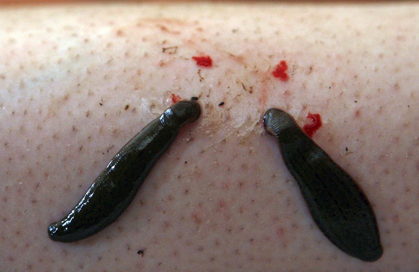 Leech identifies robber - ABC News