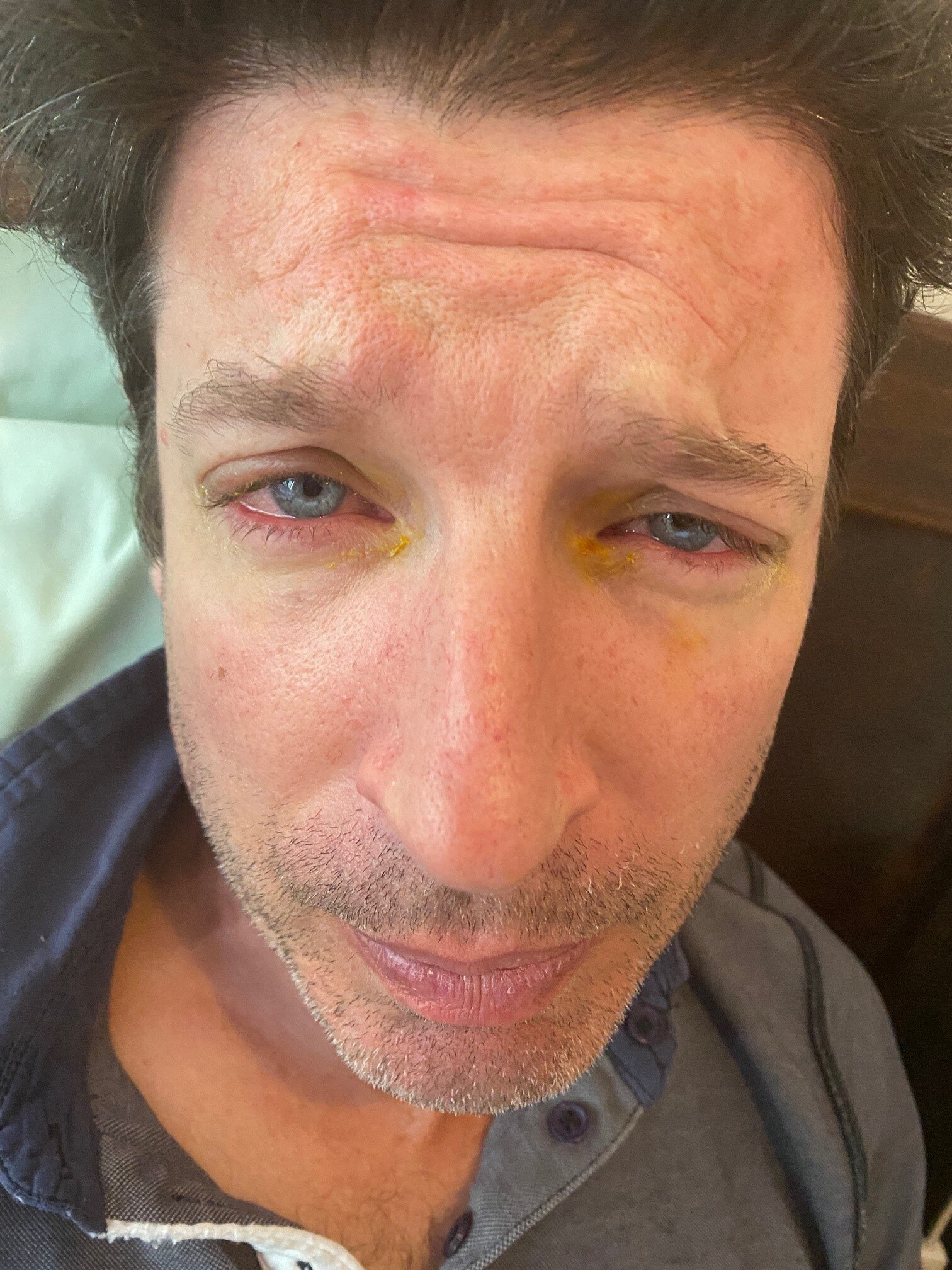 Journalists pepper sprayed by Victoria Police taking legal action - ABC ...