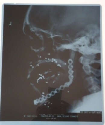 Victim describes life of suffering after having his jaw shot off in ...