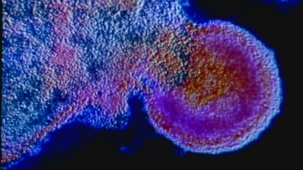 New discovery in fight against HIV - ABC News