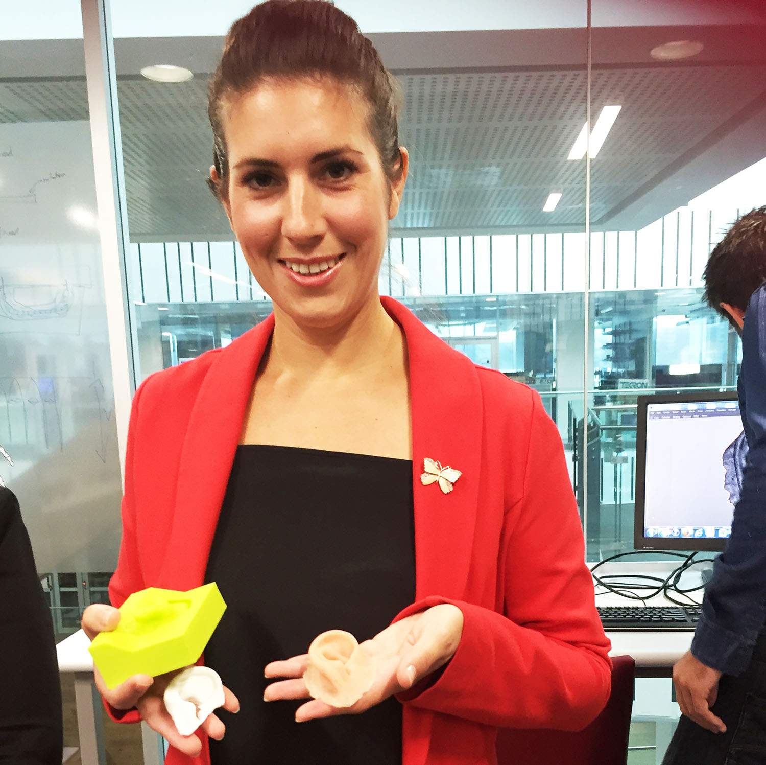 Paediatric 3D ear reconstruction gives Harriet Sanders her ears - ABC News