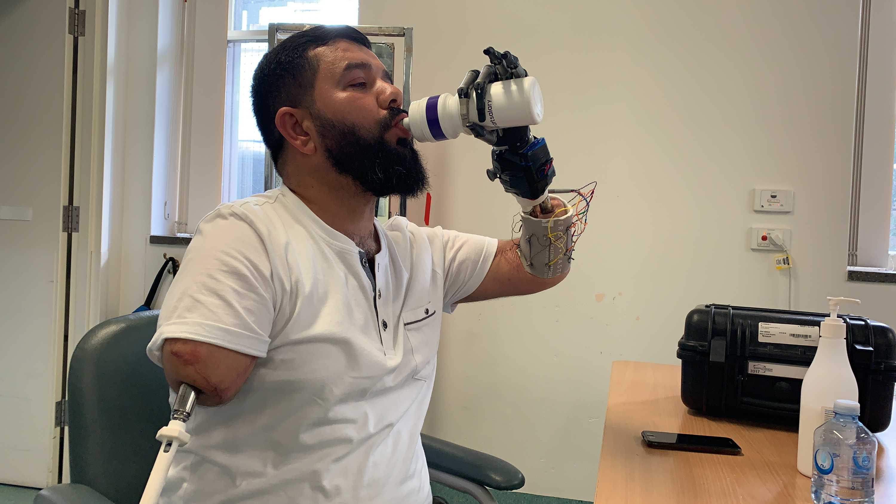Robotic arms and osseointegration surgery bring new independence to ...