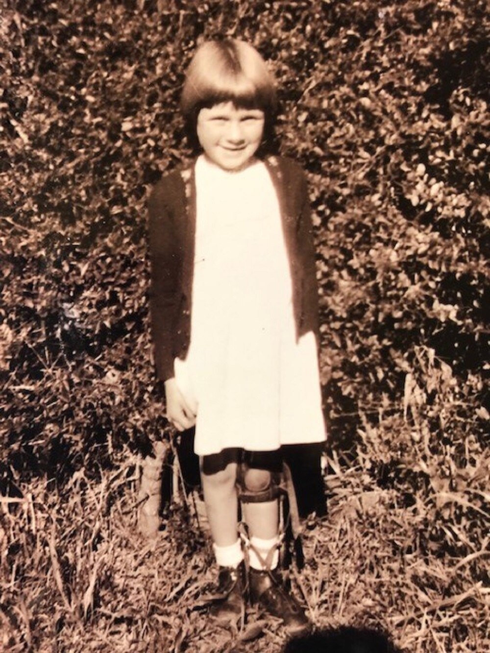 Polio survivors living with disease's lasting effects fear some might ...