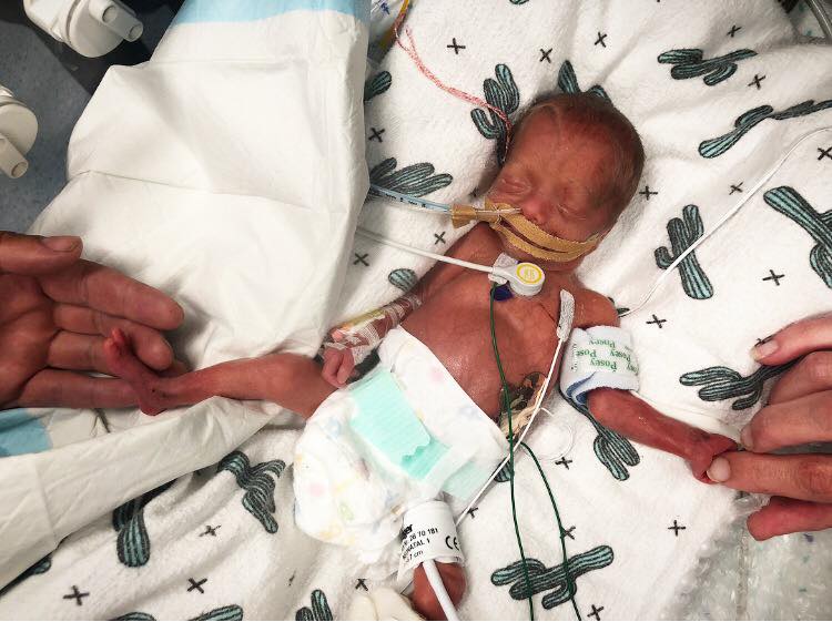 Smallest Baby In The World