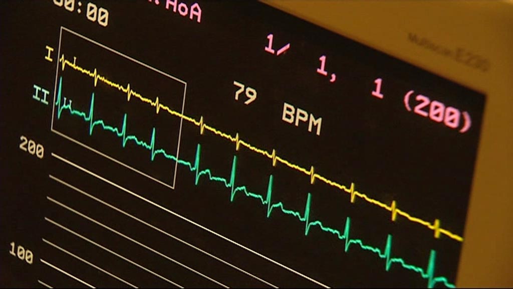 Blood test being developed to screen for secondary heart attack - ABC ...