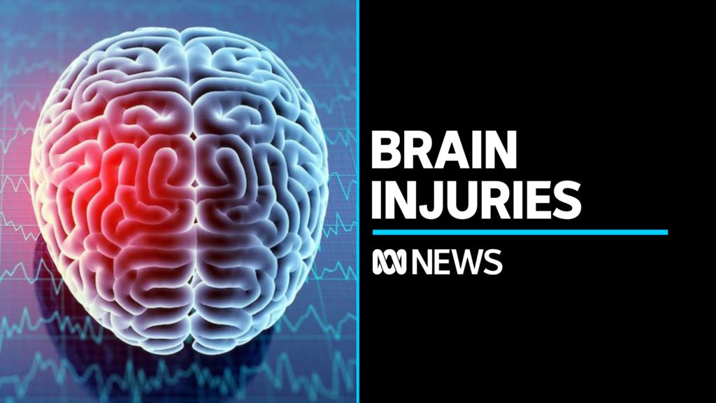 New approach uses 3D imaging to check for brain injuries - ABC News