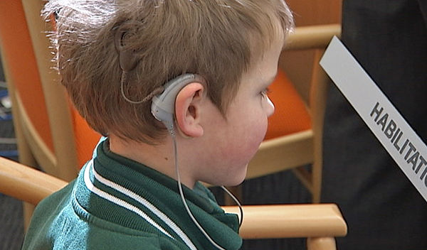 Cochlear implant clinic opens in Canberra - ABC News