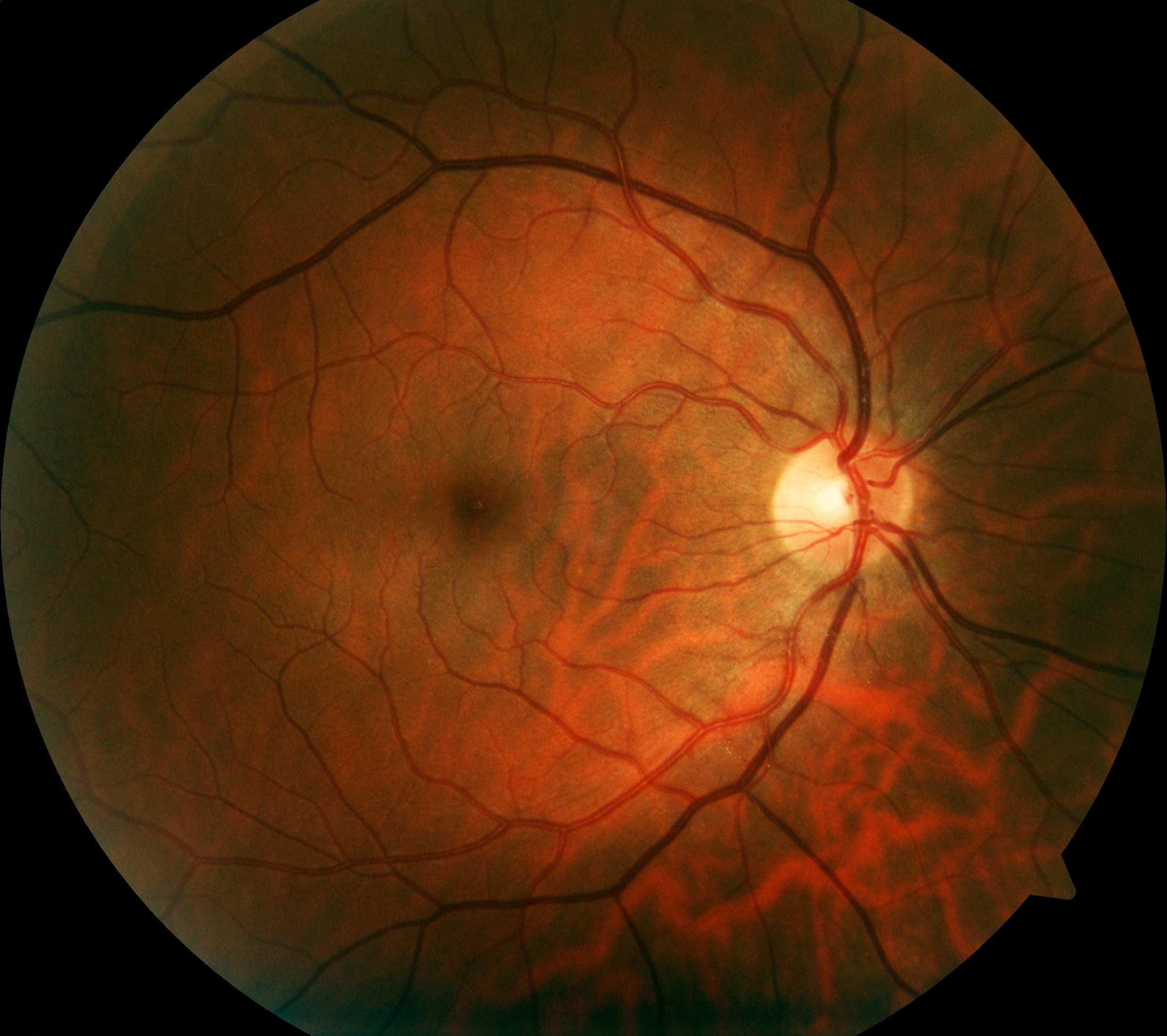 Your biological age—as seen through your retina - ABC listen