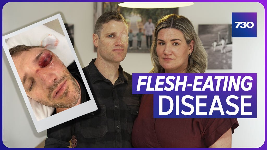 Patient loses an eye after hospital’s delayed diagnosis - ABC News