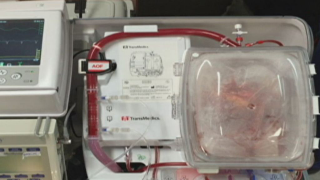 Heart beat surgery - ABC News