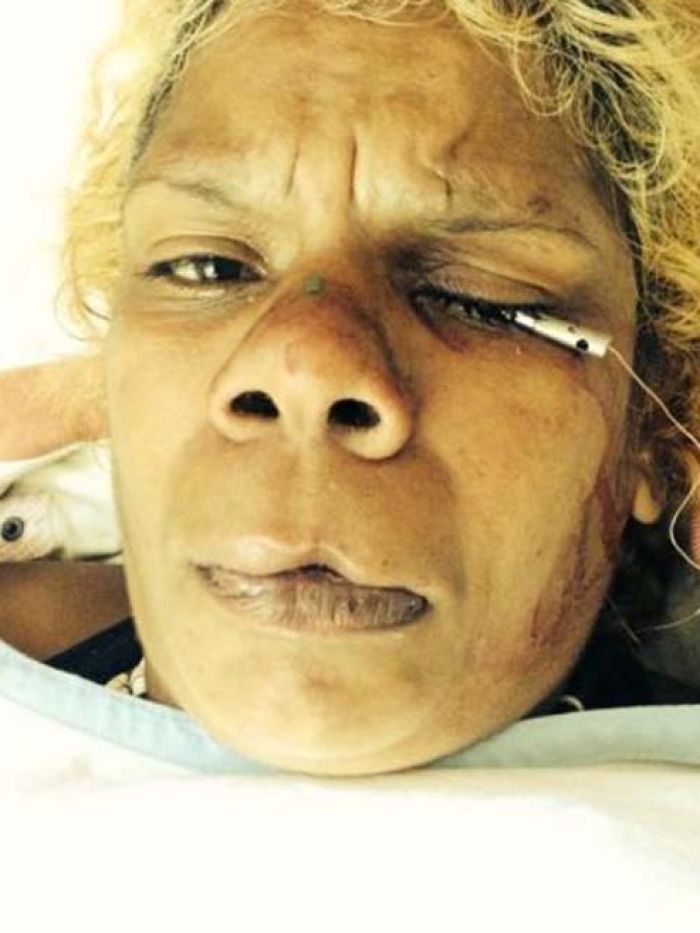 Ongoing talks for police and taser victims family - ABC listen