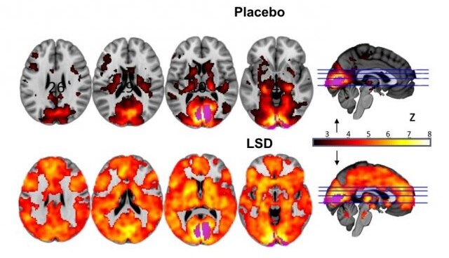 Bicycle Day marks LSD discovery by Albert Hoffman as psychotherapy ...