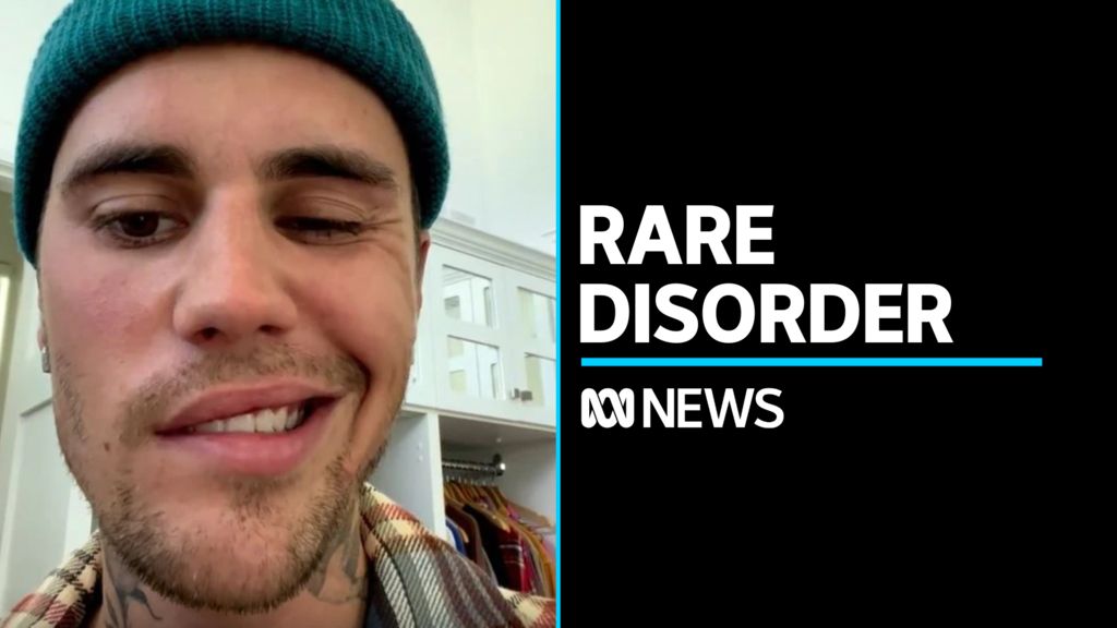 What is Justin Bieber's rare syndrome? - ABC News