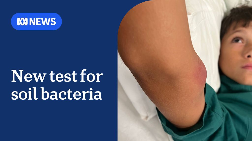 Darwin researchers develop RAT test for deadly bacteria - ABC News