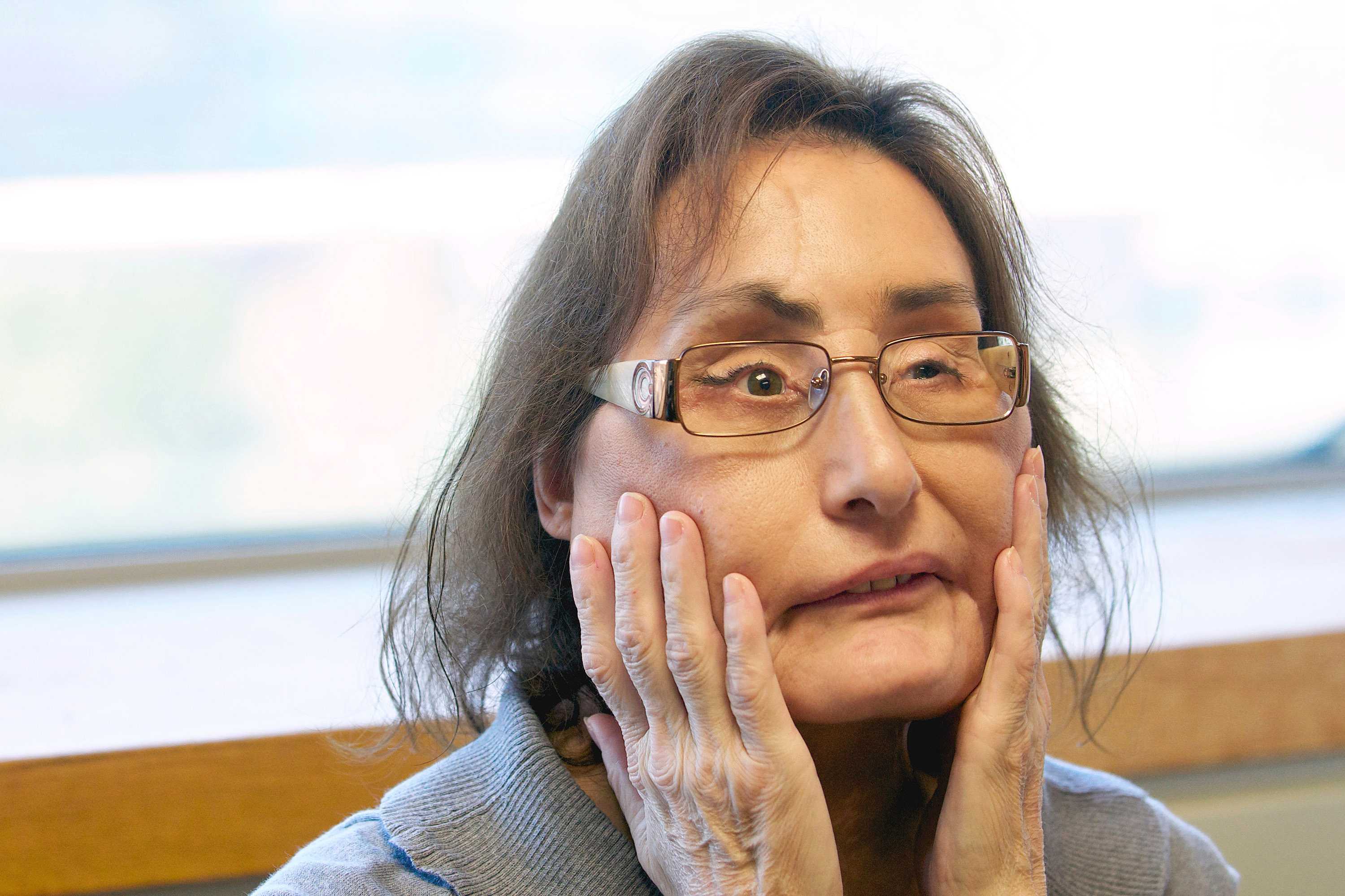 America's first partial face transplant recipient, Connie Culp, dies ...