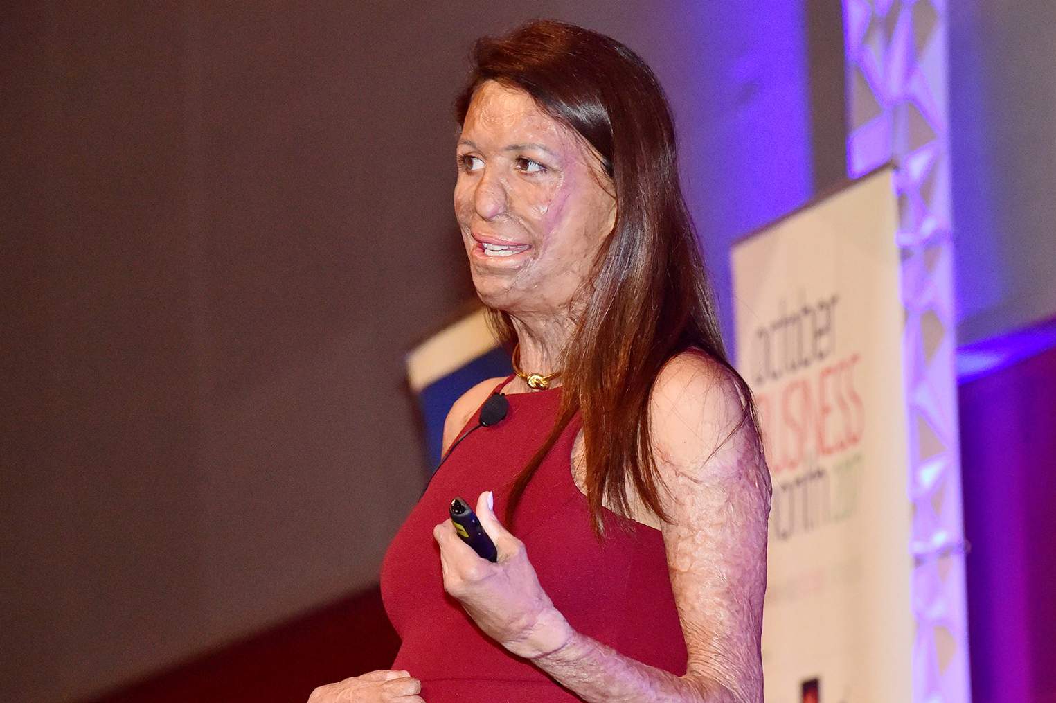 Turia Pitt inspires Northern Territory crowds before the birth of her ...